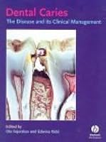 Dental Caries: The Disease and Its Clinical Management by Ole Fejerskov