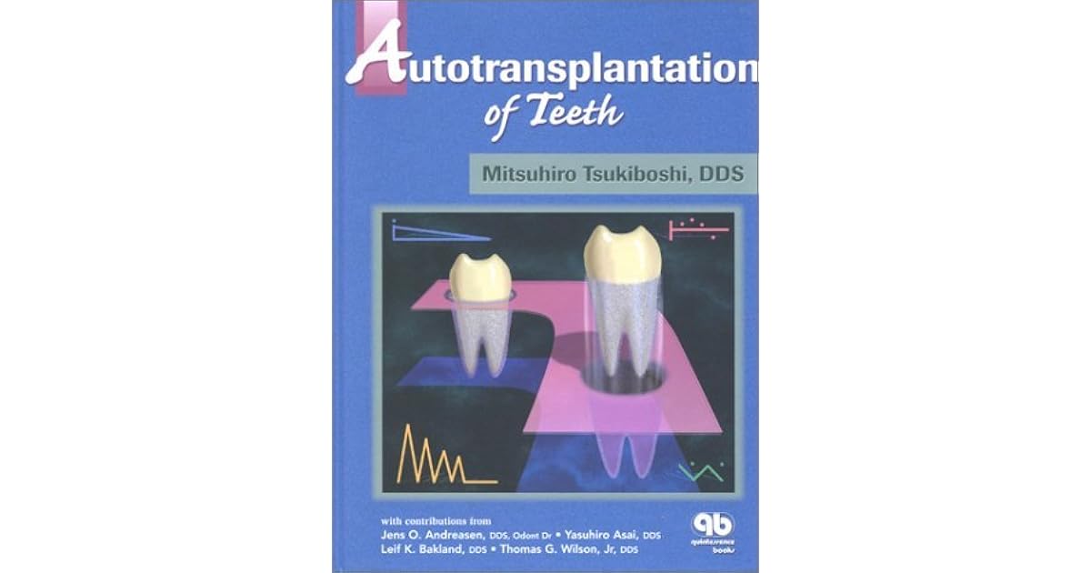 Autotransplantation of Teeth by Mitsuhiro Tsukiboshi