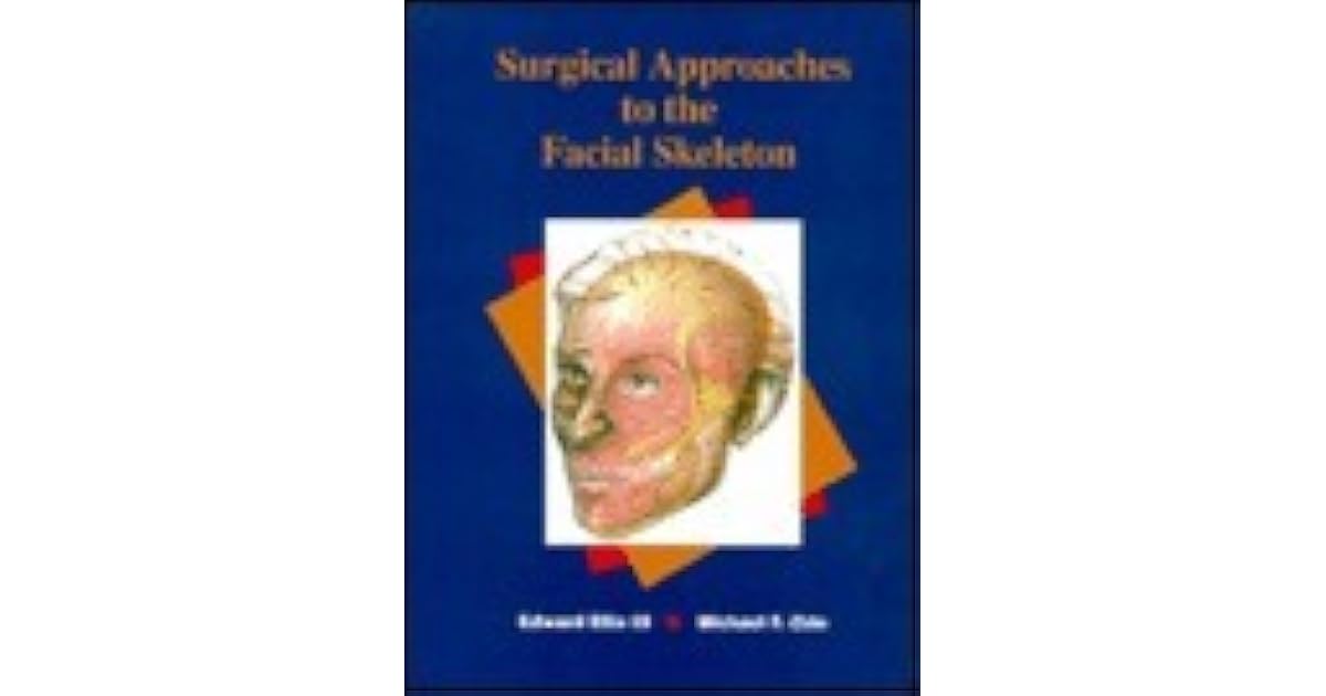 Surgical Approaches to the Facial Skeleton by Edward Ellis III
