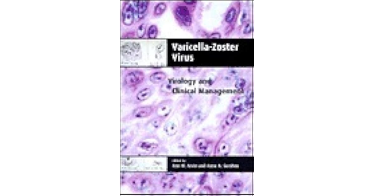 Varicella-zoster Virus: Virology and clinical management by Ann M. Arvin