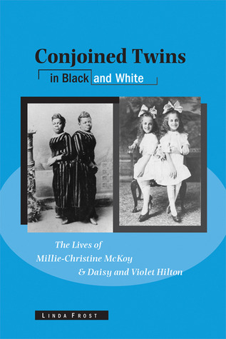 Conjoined Twins in Black and White: The Lives of Millie-Christine McKoy ...
