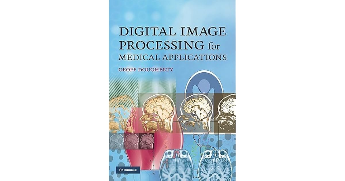 Digital Image Processing for Medical Applications by Geoff Dougherty