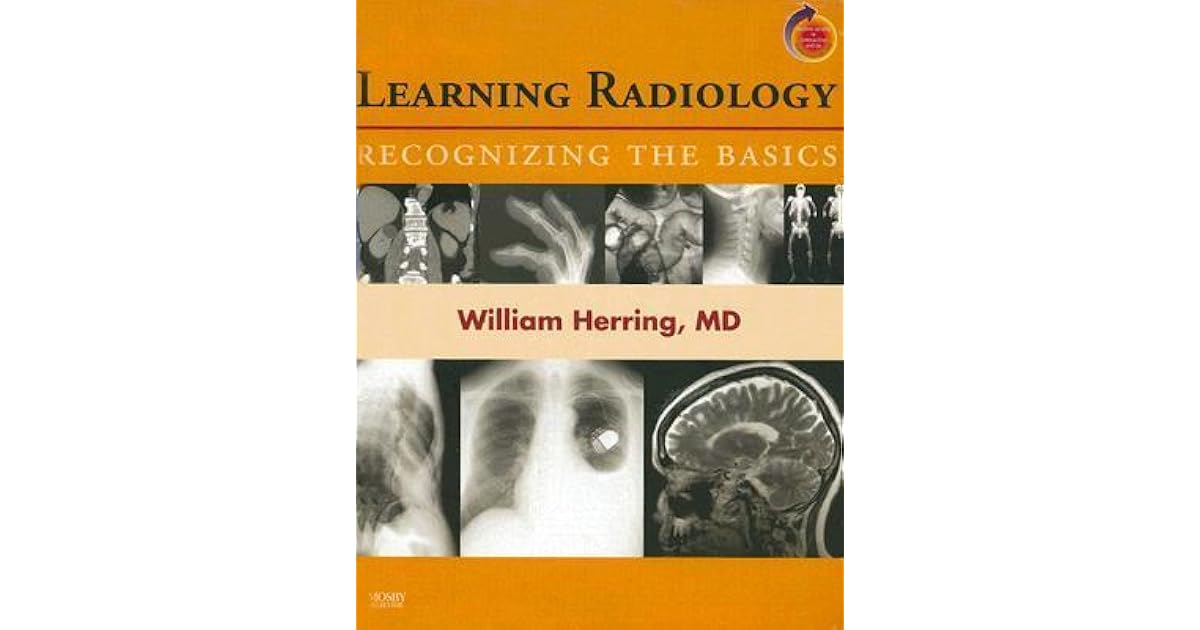 Learning Radiology: Recognizing the Basics [with Student Consult Online ...