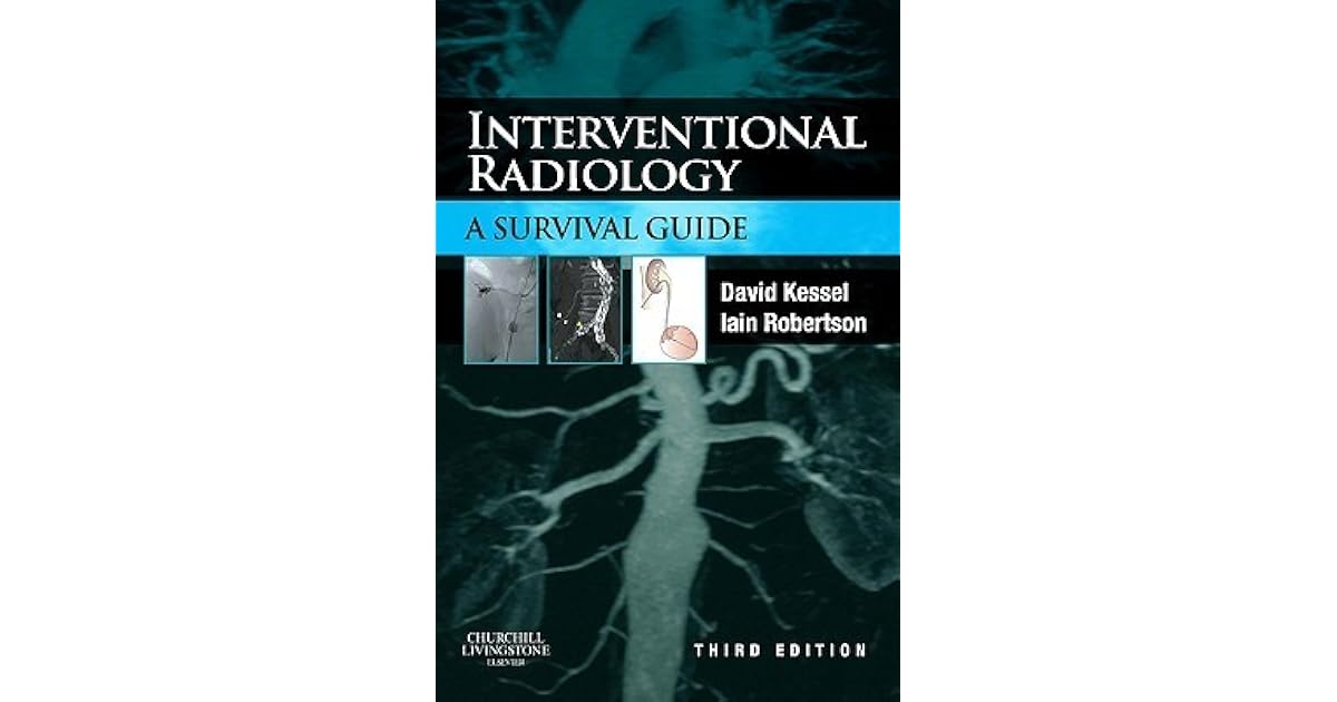 Interventional Radiology: A Survival Guide by David Kessel