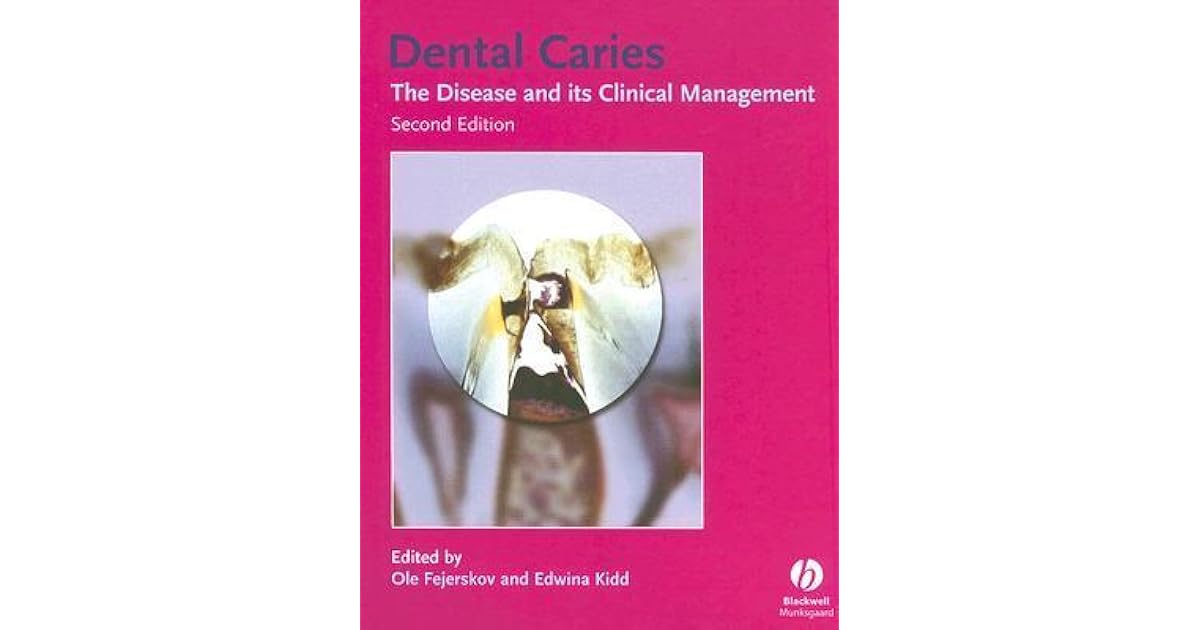 Dental Caries: The Disease and Its Clinical Management by Ole Fejerskov