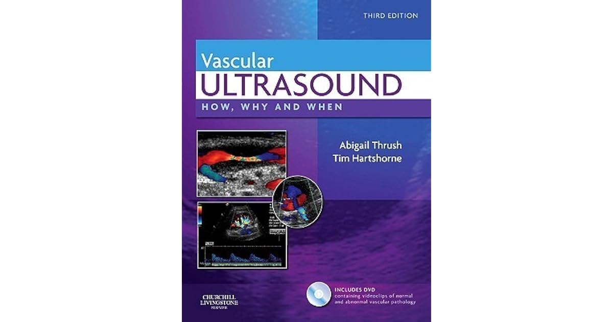 Vascular Ultrasound: How, Why and When by Abigail Thrush