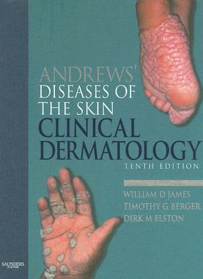 Andrews' Diseases of the Skin: Clinical Dermatology by William D. James