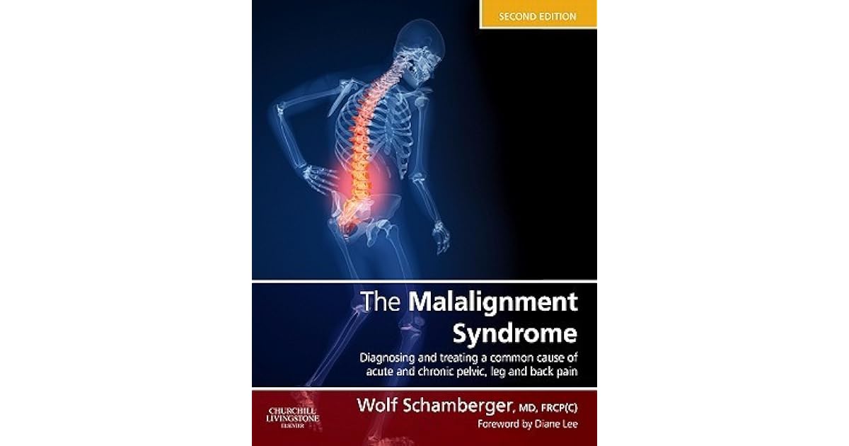 The Malalignment Syndrome: diagnosis and treatment of common pelvic and ...