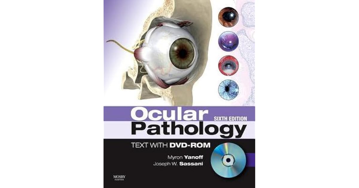 Ocular Pathology by Myron Yanoff