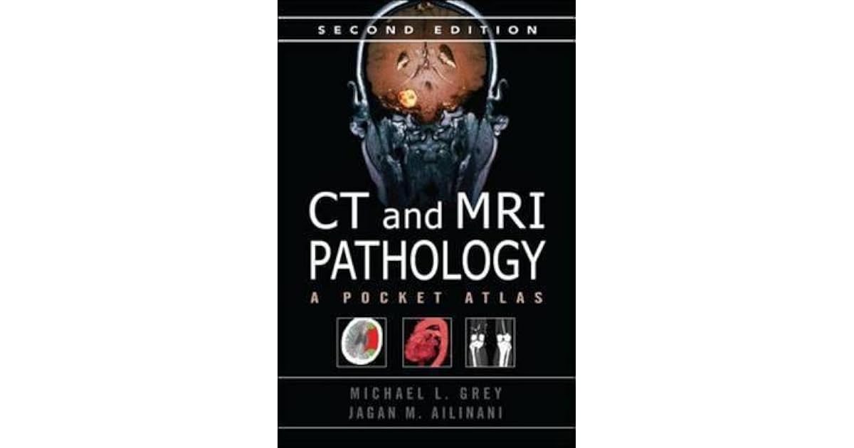 CT & MRI Pathology: A Pocket Atlas by Michael L. Grey