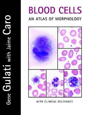 Blood Cells: An Atlas of Morphology with Clinical Relevance by Gene Gulati