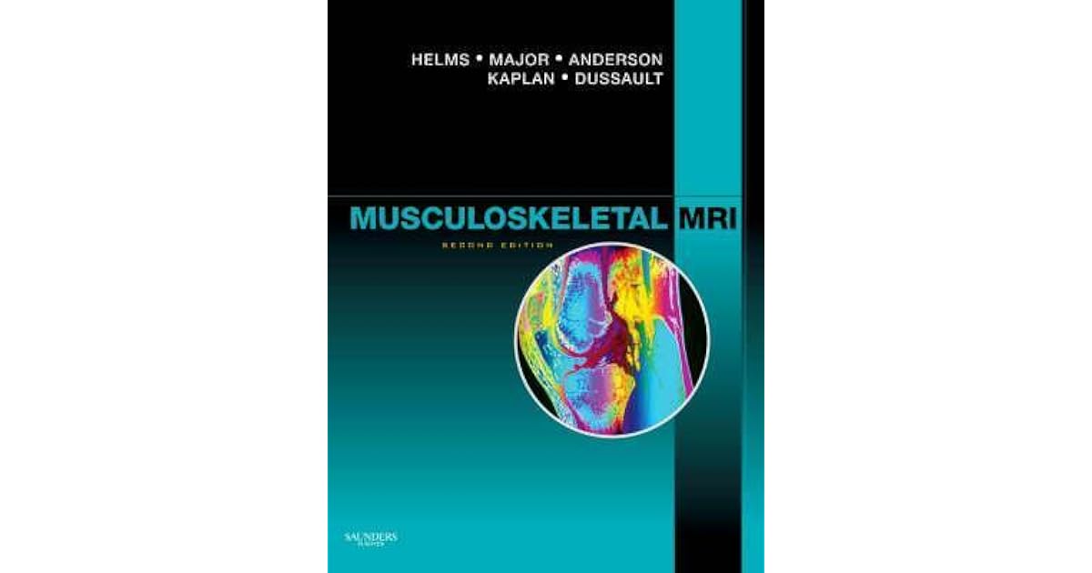 Musculoskeletal MRI by Clyde A. Helms