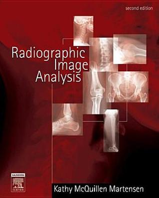 Radiographic Image Analysis by Kathy McQuillen Martensen