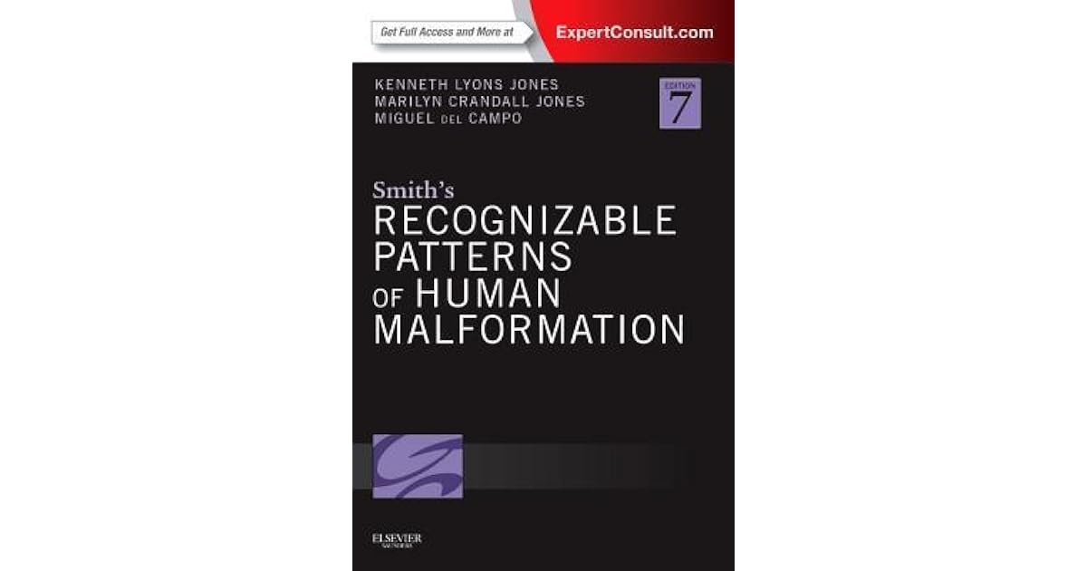 Smith's Recognizable Patterns of Human Malformation: Expert Consult ...