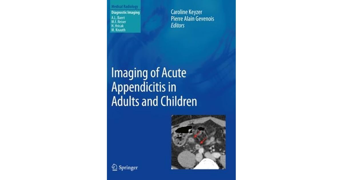 Imaging of Acute Appendicitis in Adults and Children by Caroline KEYZER