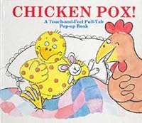 Chicken Pox!: Touch Feel Pop-Up Book by Shen Roddie