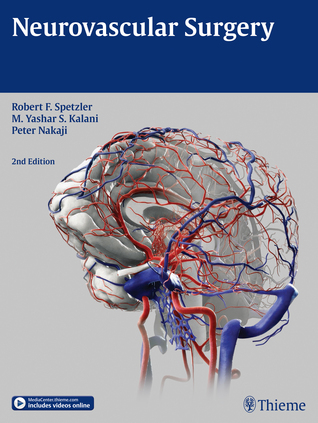 Neurovascular Surgery by Robert F. Spetzler