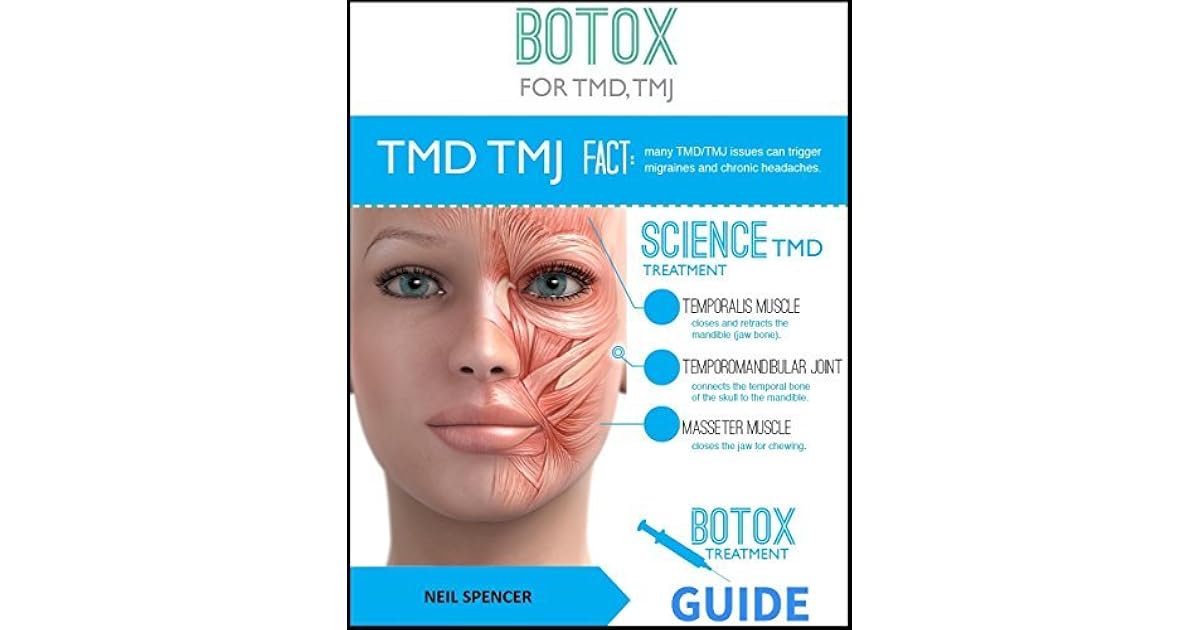 Temporomandibular Joint Disorders TMD TMJ And Botox Treatment Guide ...