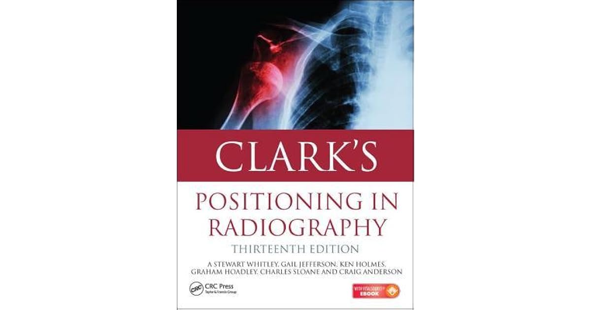 Clark's Positioning in Radiography by A. Stewart Whitley