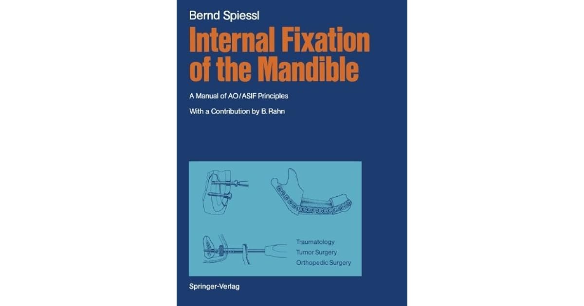 Internal Fixation of the Mandible: A Manual of Ao/Asif Principles by ...