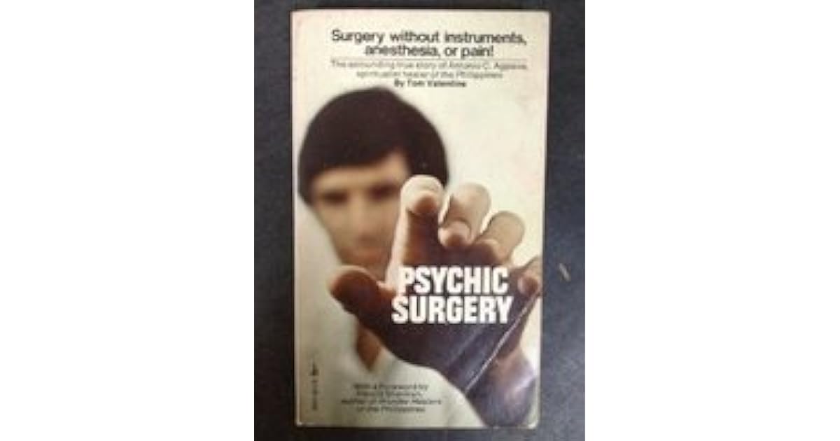 Psychic Surgery by Tom Valentine