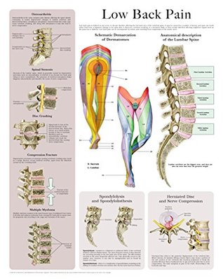 Low Back Pain e-chart: Quick reference guide by HC-HealthComm