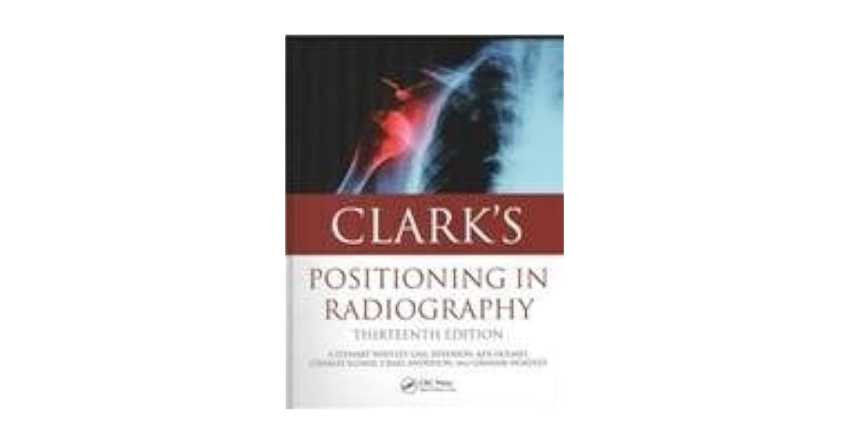 Clark's Positioning in Radiography by Adrian D. Moore,Graham Hoadley ...