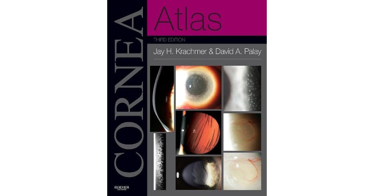Cornea Atlas by Jay H. Krachmer