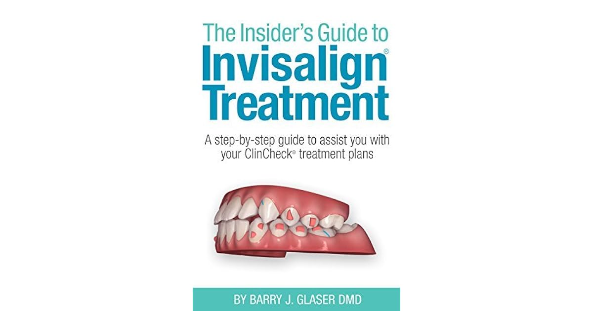 The Insider's Guide to Invisalign Treatment: A step-by-step guide to ...