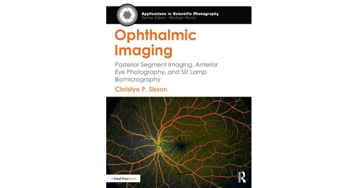 Ophthalmic Imaging: Posterior Segment Imaging, Anterior Eye Photography ...