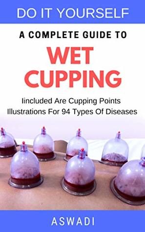 Do it yourself - a complete guide to wet cupping: Iincluded Are Cupping ...