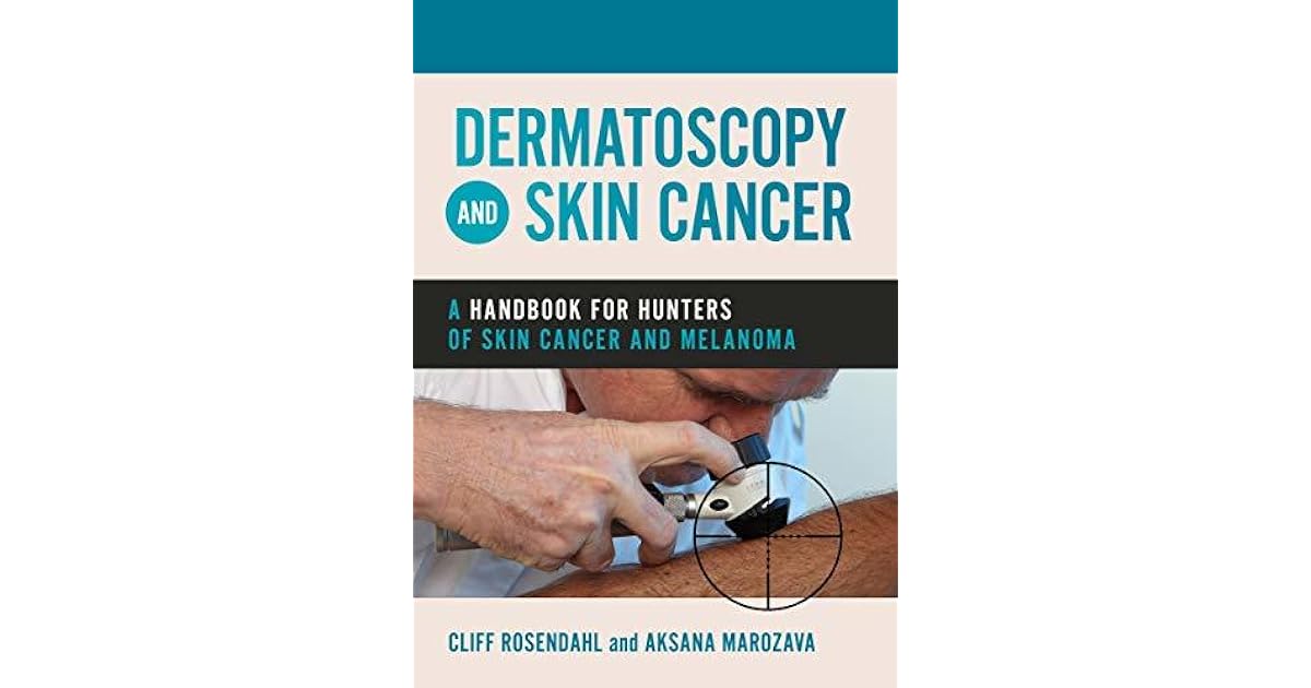 Dermatoscopy and Skin Cancer: A handbook for hunters of skin cancer and ...