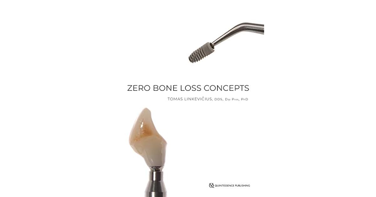 Zero Bone Loss Concepts by Tomas Linkevicius