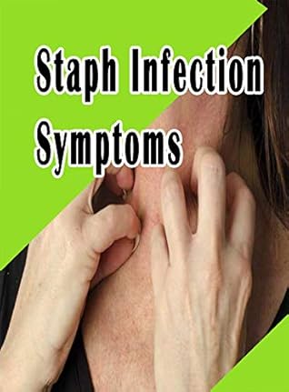 Staph Infection Symptoms: Folliculitis - Boils - Fever - Swelling ...