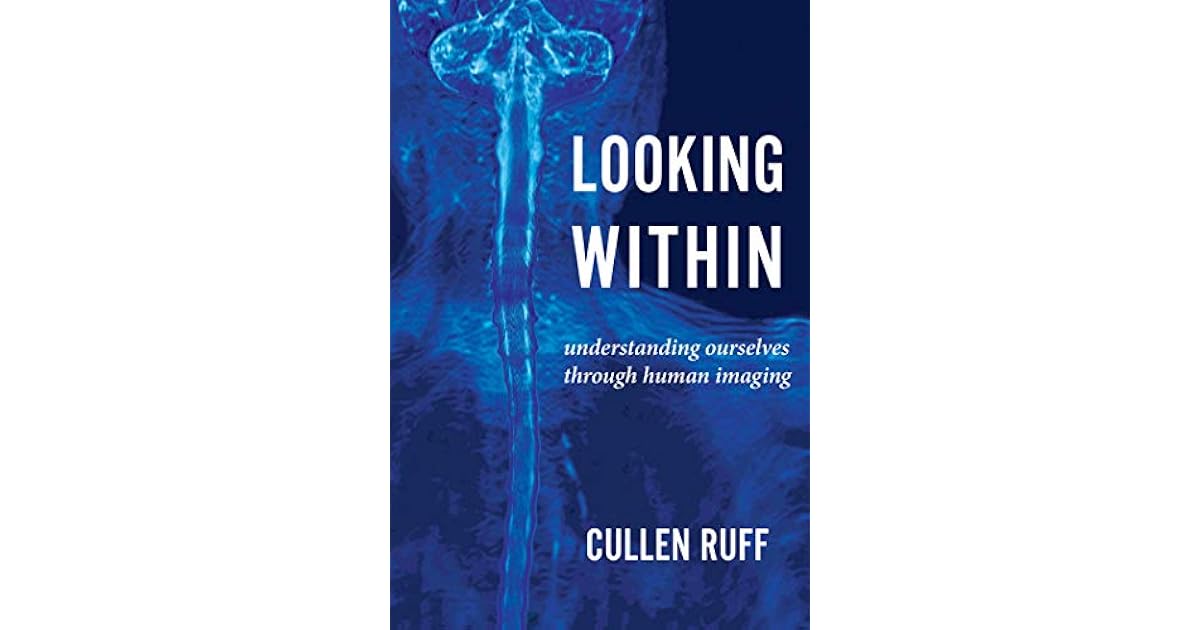 Looking Within: Understanding Ourselves through Human Imaging by Cullen ...