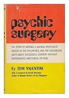 Psychic Surgery by Tom Valentine