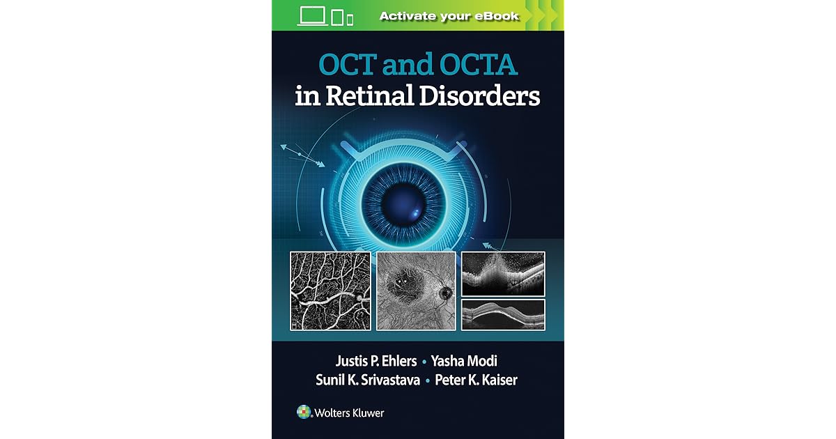 OCT and OCTA in Retinal Disorders by Justis P. Ehlers