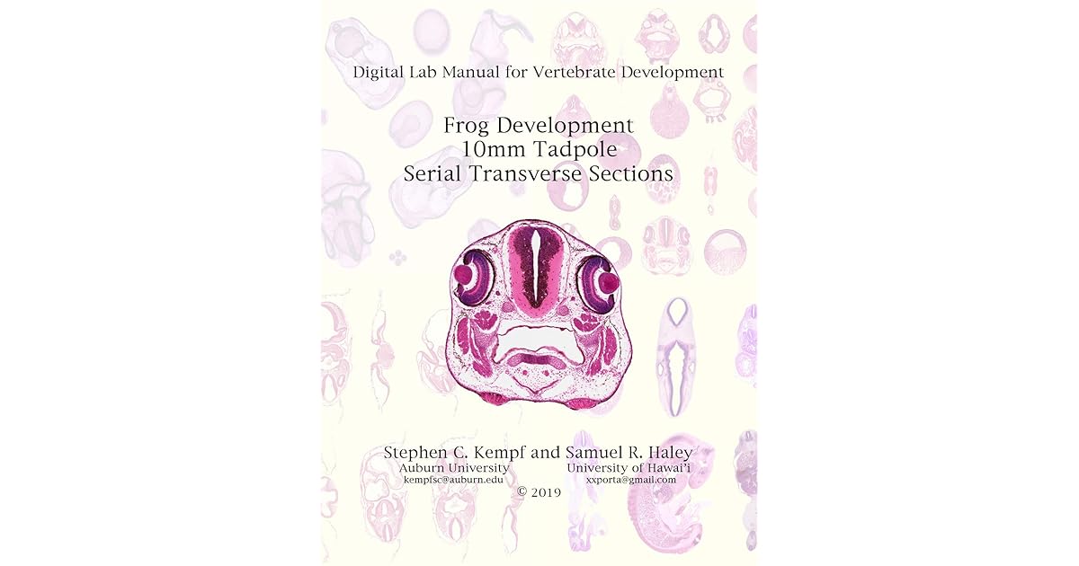 10mm Frog Tadpole Serial Transverse Sections: Digital Lab Manual for ...
