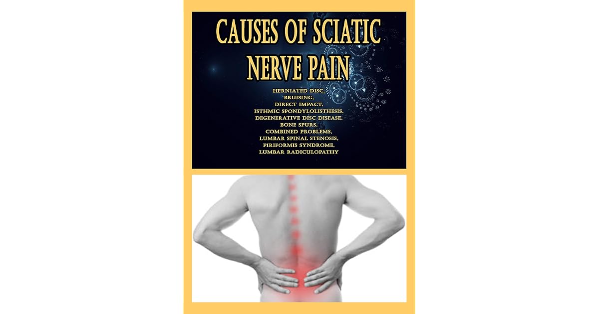 Causes of Sciatic Nerve Pain: Herniated Disc, Bruising, Direct Impact ...