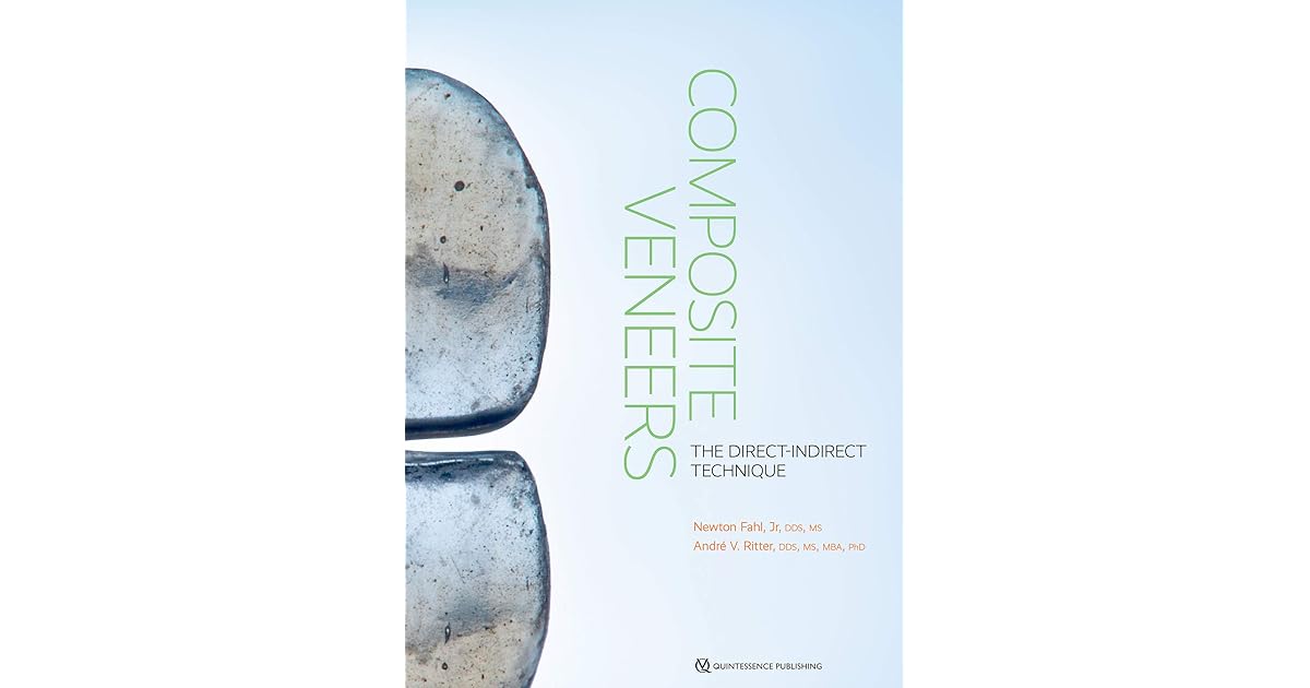 Composite Veneers: The Direct-Indirect Technique by Newton Fahl
