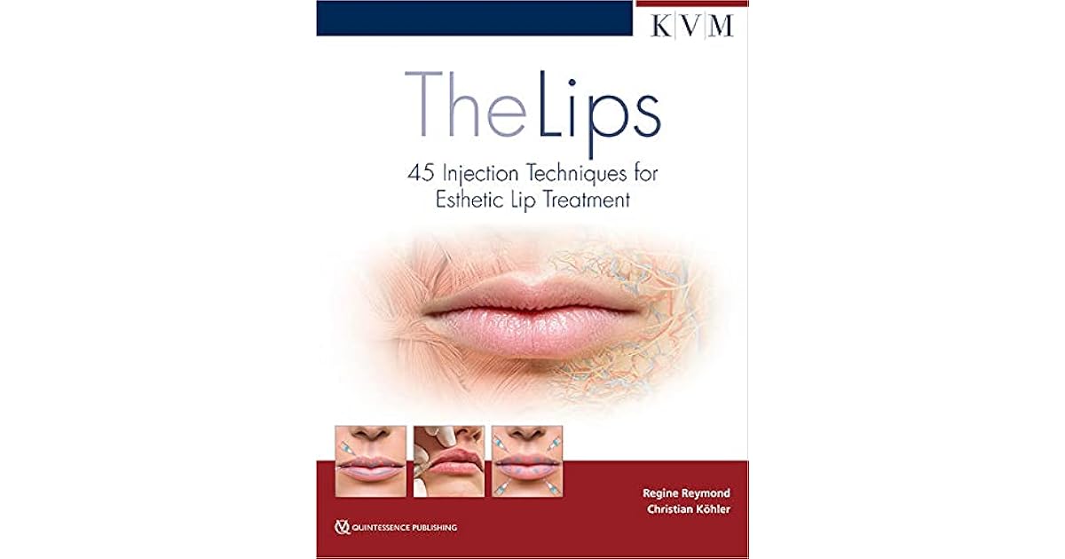 The Lips: 45 Injection Techniques for Esthetic Lip Treatment by Regine ...