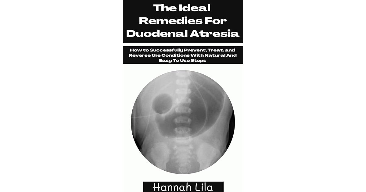 The Ideal Remedies For Duodenal Atresia: How to Successfully Prevent ...