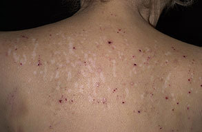 ƛƧƳԼƲM ƑƠƦ ƬӇЄ ƇƦƖMƖƝƛԼԼƳ ƖƝƧƛƝЄ {ˢᵉᵐᶦ⁻ᵃᵈᵛᵃᶰᶜᵉᵈ ʳᵒᶫᵉᵖᶫᵃʸ} - Archives ...